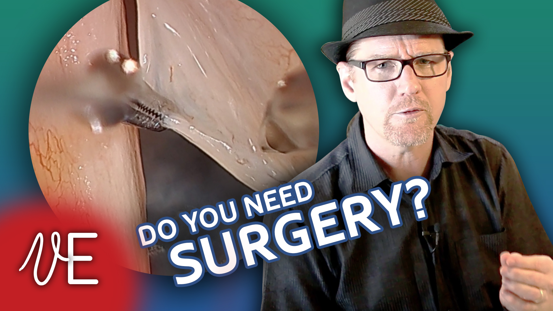 Vocal Fold Cyst: Diagnosis, care and treatment for Singers